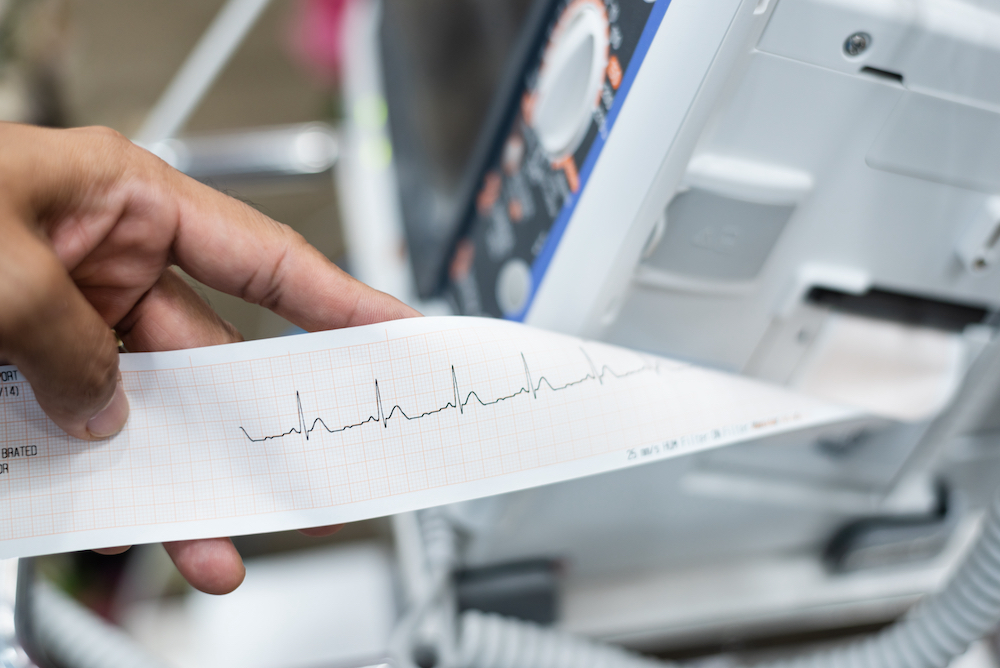 Close,Up,Of,Cardiologist,Doctor,Holding,And,Reading,Ekg,Paper - Saint ...